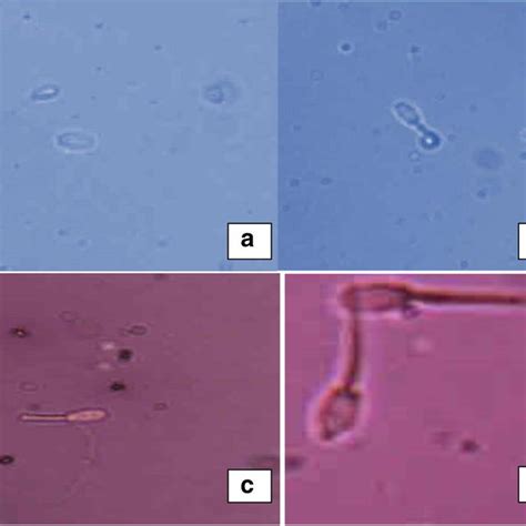 Sperm Morphological Abnormalities Abnormalities Description Primary Download Scientific Diagram