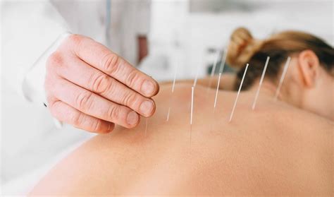 Does Acupuncture Cause Bleeding Lycoming Orthopedics And Sports