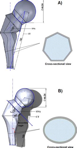 Design And Fabrication Of A Customized Partial Hip Prosthesis Employing