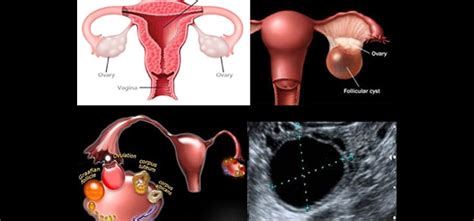 Ovariumhistologie Gelabelde Graafiaanse Follikel