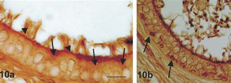 A Type I Epithelium Gsa Ib4 Staining Pcs Exhibit A Moderate Reaction