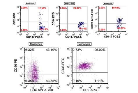 Hematopathology Case Study A 69 Year Old Female With Persistent