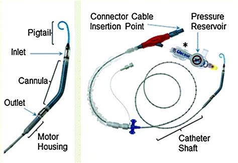 Acute Mitral Regurgitation Unforeseen New Complication Of The Impella
