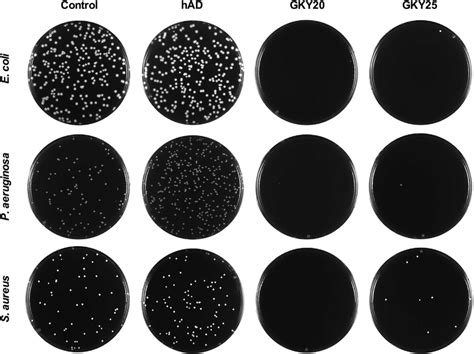 Peptide Coated Human Acellular Dermis Discs Inhibit Bacterial Growth Download Scientific