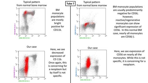 Case Study Interpretation Ppt Download