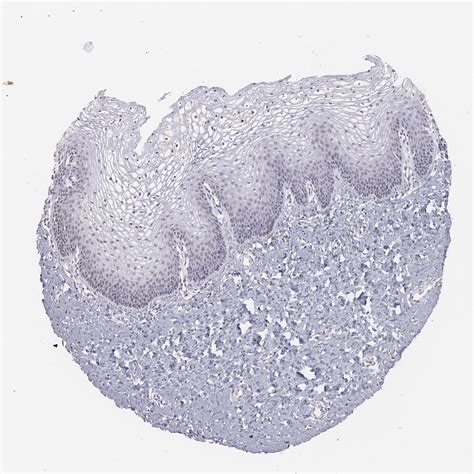 Tissue Expression Of Rbm39 Staining In Vagina The Human Protein Atlas