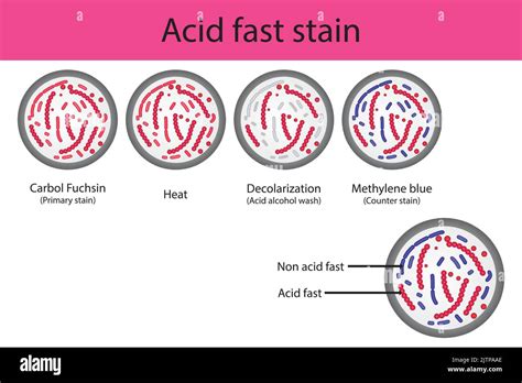 Capsule Stain Procedure