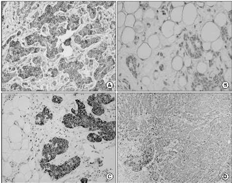 Immunohistochemical Staining Of Leptin A B And Obr C D A