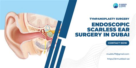 Exploring Endoscopic Ear Surgery A Minimally Invasive Technique For Treating Ear Conditions