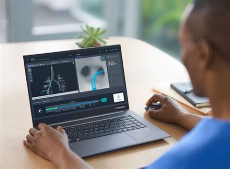 Ion Robotic Bronchoscopy Designed To Advance Lung Cancer Care