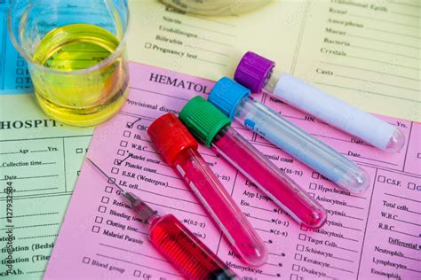 Blood And Urine For Health Check Blood Samples And Urime Sample Stock