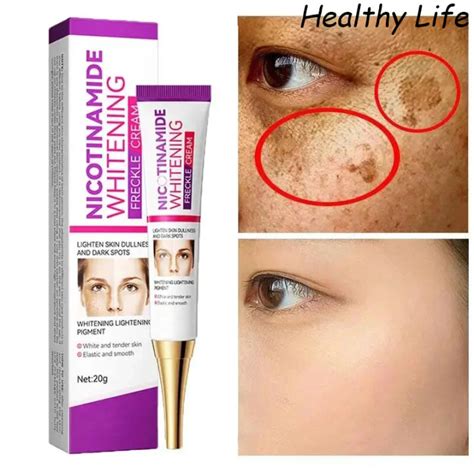 Mild Niacinamide Lightening Melasma Cream Effectively Fade Melanin