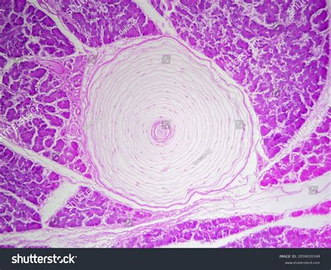 Pacinian Corpuscles Histology