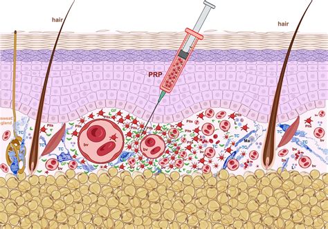 Platelet Rich Plasma In Dermatology New Insights On The Cellular