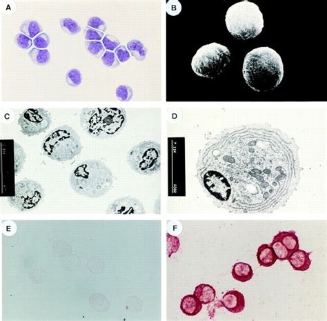 Morphology Of Freshly Isolated Cd4⁺cd11c⁻cd3⁻ Plasmacytoid Cells A