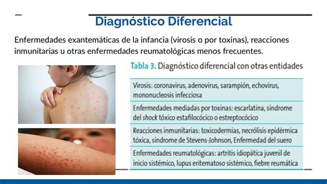 Diferencial De Exantema Viral Viral Exanthems Unravelling Viral