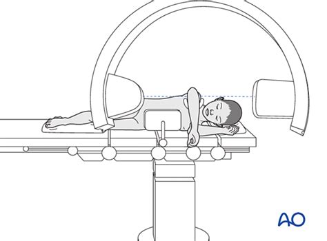 Lateral Decubitus Position