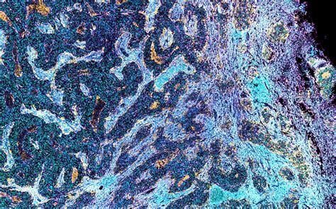Microscopy And Image Analysis Facility School Of Biomedical Sciences