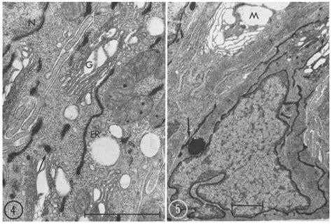 This Micrograph Illustrates The Localization Of Peroxidase Reaction In Download Scientific