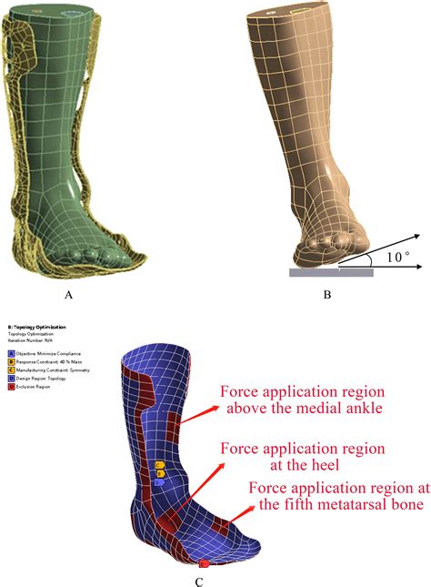 An Exploration Into The Orthopedic Effect And Patterns Of The