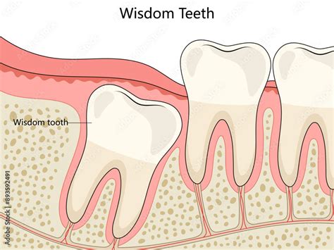 Position And Structure Of Wisdom Teeth In The Human Jaw Structure