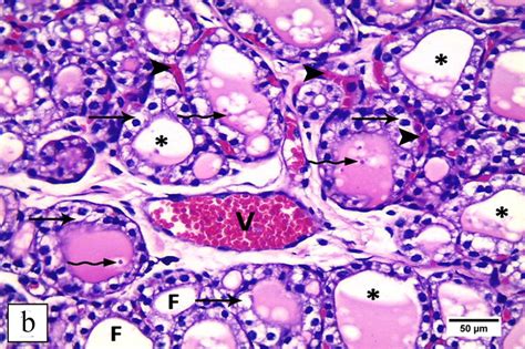 B Thyroid Gland Section Of The Li Treated Group Showing Disorganized