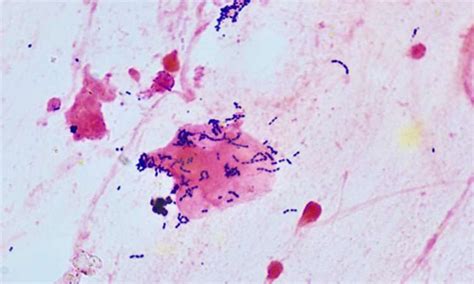 Gram Positive Cocci In Chains