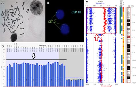 The Detection Of The Foetus With The Foetal Cord Blood Sample A