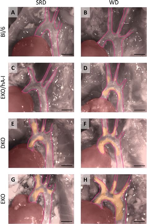 The Transcriptome Profiling Of Diseased Mouse Aortas Discloses A