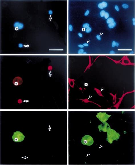 Dilichos Biflorus Agglutinin Dba Staining Of Epithelial Cells And Download Scientific Diagram