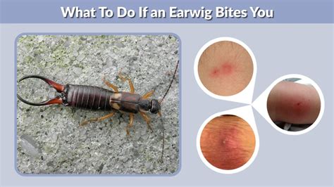 Do Earwigs Bite The Complete Guide To Earwig Behavior Pinches Symptoms And Safety