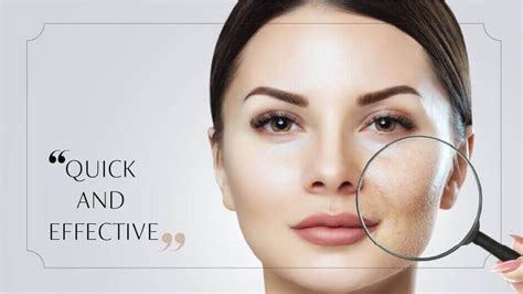 How Is The Safe Stain Treatment Doku Clinic