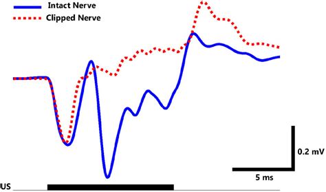 Emg Responses Before And After Nerve Clip The Blue Line Is The
