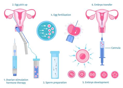 After Embryo Transfer Day By Day Symptoms What To Expect Each Step Of