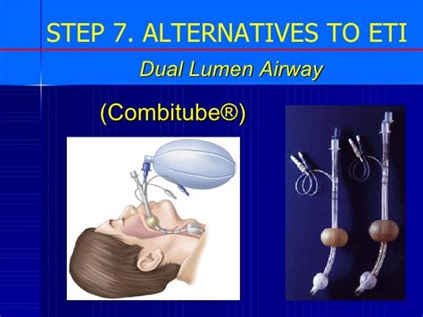 Airway Algorithm Review