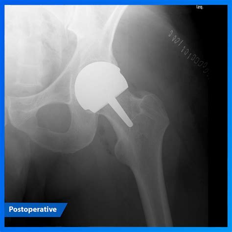 Medcom Tech On Linkedin Medcomtech Siempreconlosmedicos Adept