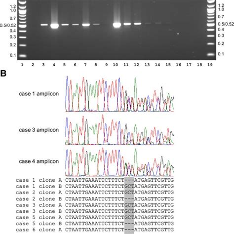 detection by pcr of atp synthase subunit γ sequences diagnostic of t