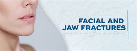 Facial And Jaw Fractures Op Dr Ahmet Körmutlu