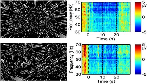 Possible Eeg Indicator Of Vection Left Representations Of A Radially