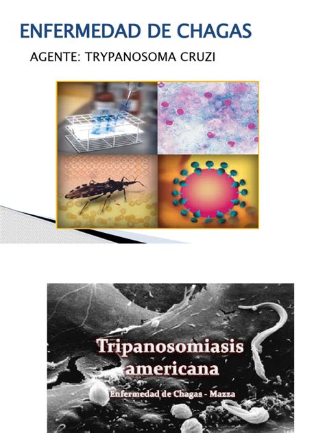 2enfermedad De Chagas Nueva Actual Pdf Sistema Inmune Inmunidad