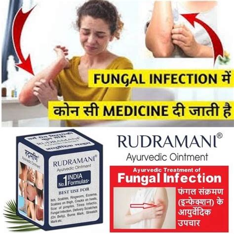 Antifungal Cream Ointment Harbal Ointment Rudtamani Ointment At ₹ 100