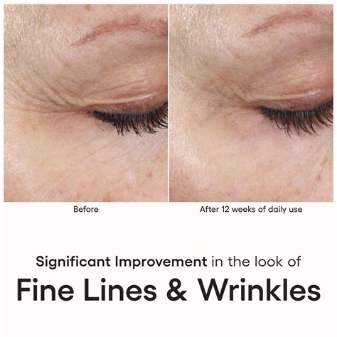Plated Intense Serum On Sale Now