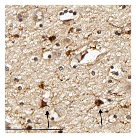 Different Morphologies Of Microglia In Ad Pd And Nc A B