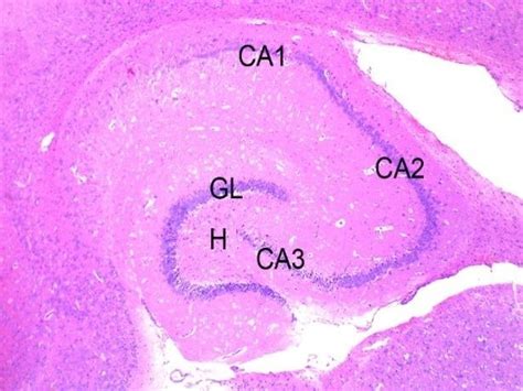 Hippocampus Rat Control Group Panoramic View Ca1 Ca1 Pyramidal