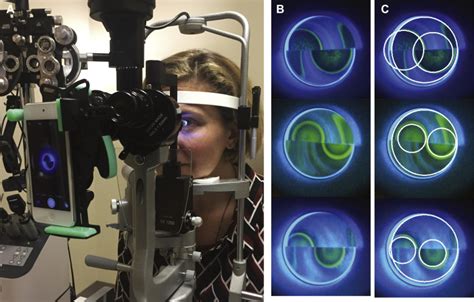 Using Deep Learning To Automate Goldmann Applanation Tonometry Readings