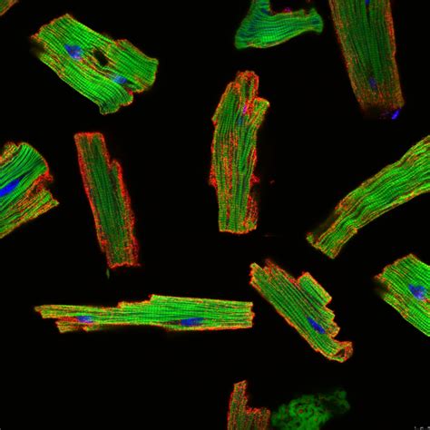 Imces Calendarlife Beyond Vision