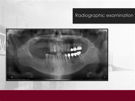 Dental Clinical Case Presentation Pptx Oral Care Personal Care