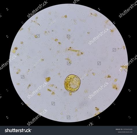 What Is Microscopic Examination Of Stool At Sharon Russell Blog