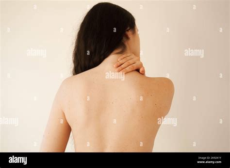 Cervical Spine Osteochondrosis Is Radicular Syndromes Of Young Woman