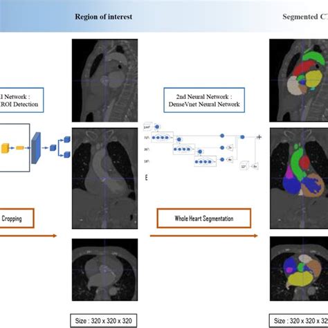 Deep Learning Based Whole Heart Segmentation Workflow A Native Download Scientific Diagram